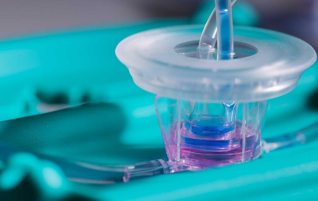 Epithelial Barrier Integrity Assay | React4Life