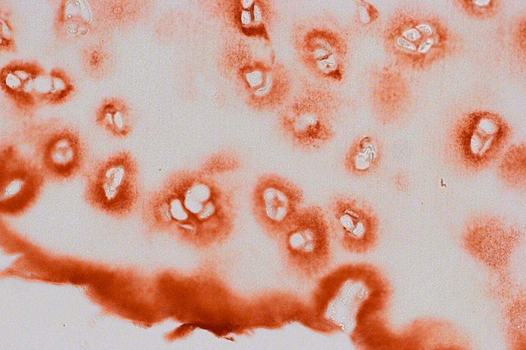 Immune on Chip: Multi-Organ on Chip | React4life