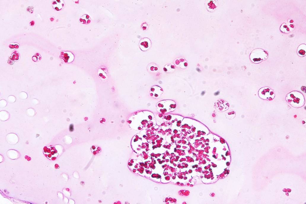 Cancer on Chip: Innovative Cancer Research | React4life