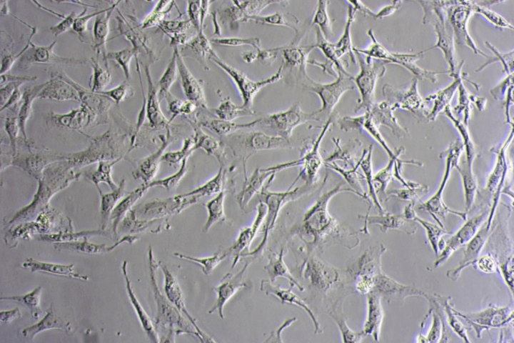 Cancer on Chip: Innovative Cancer Research | React4life