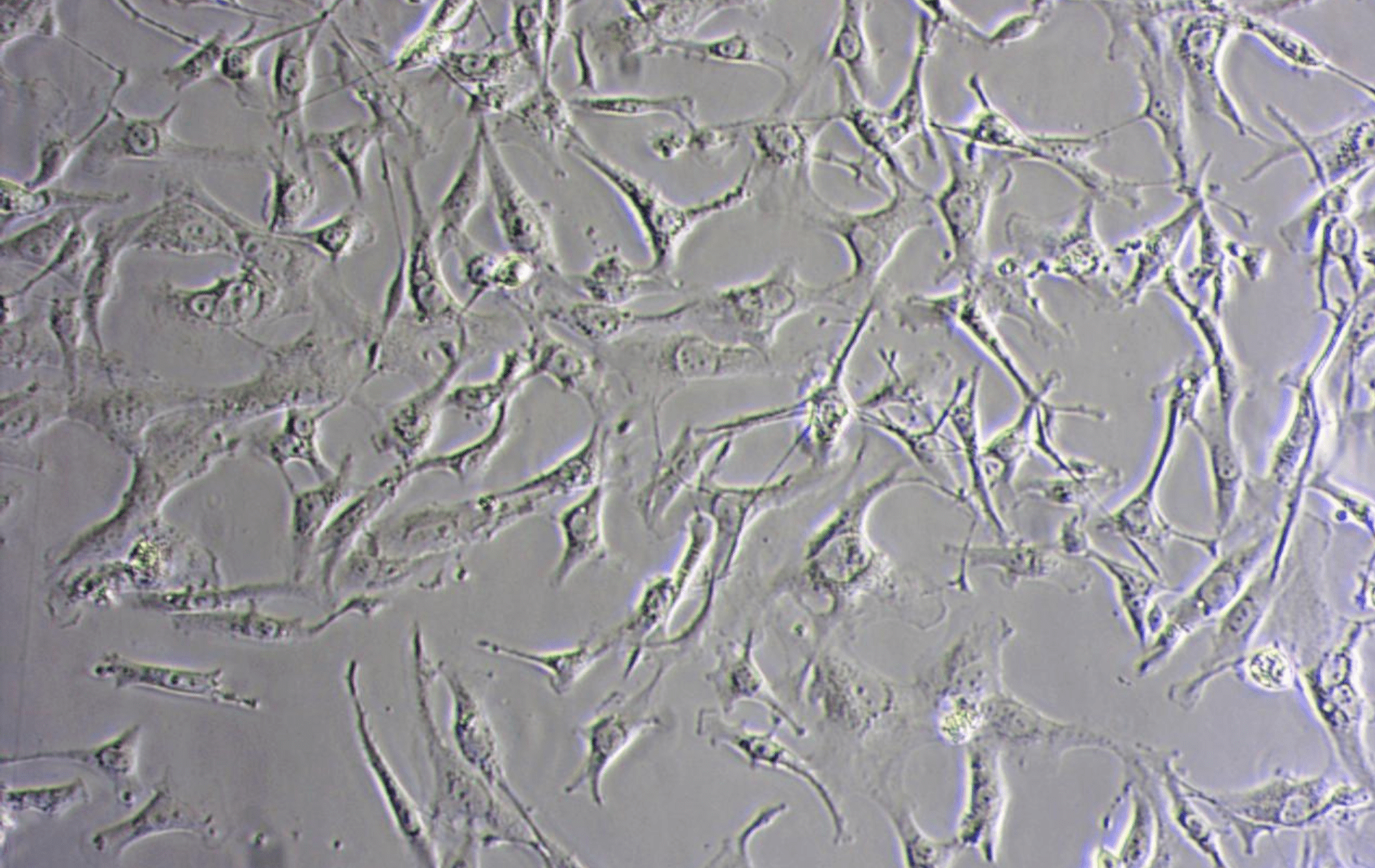 CANCER-on-CHIP