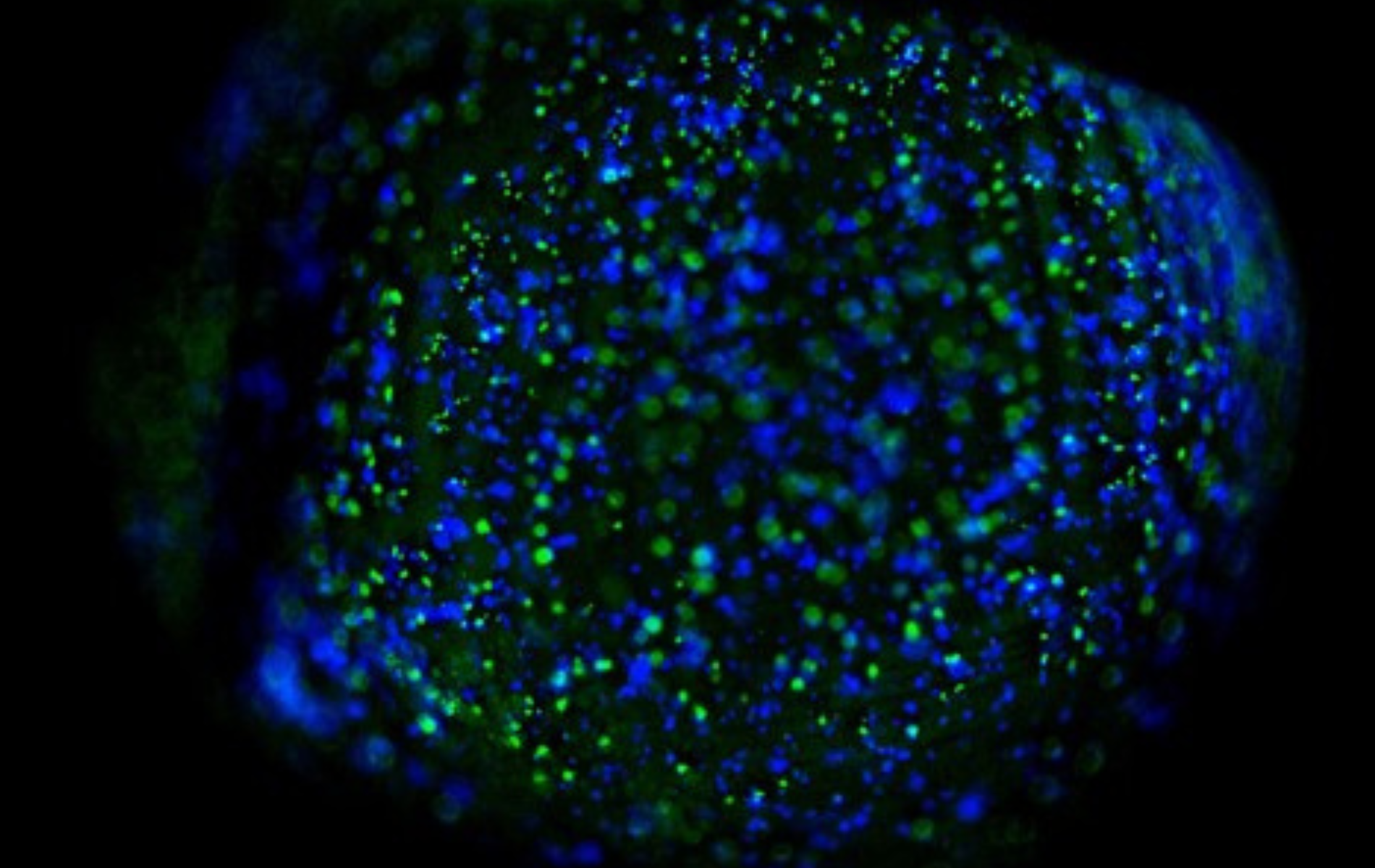 CANCER-on-CHIP