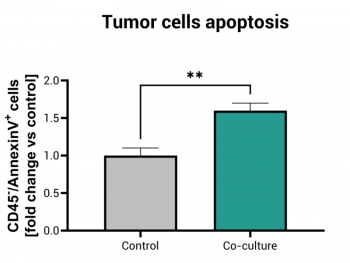 Immune Cells Infiltration Assay | React4Life